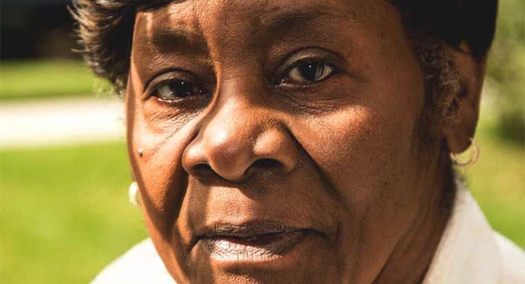 16 Symptoms of Stroke in Women: Treatment, and Prevention