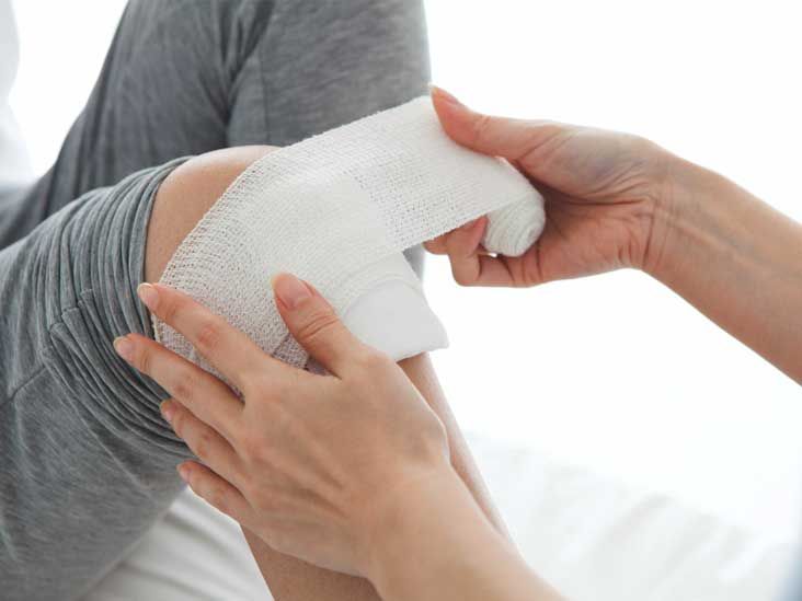 Purulent Drainage: Definition, Complications, and Treatment