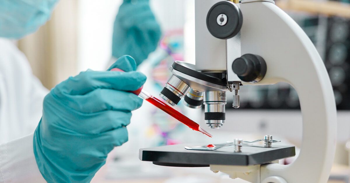 Hepatitis C (HCV) Genotype: Your Questions Answered