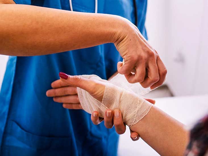 Triquetral Fracture: Symptoms, Causes, Treatment, and Healing Time