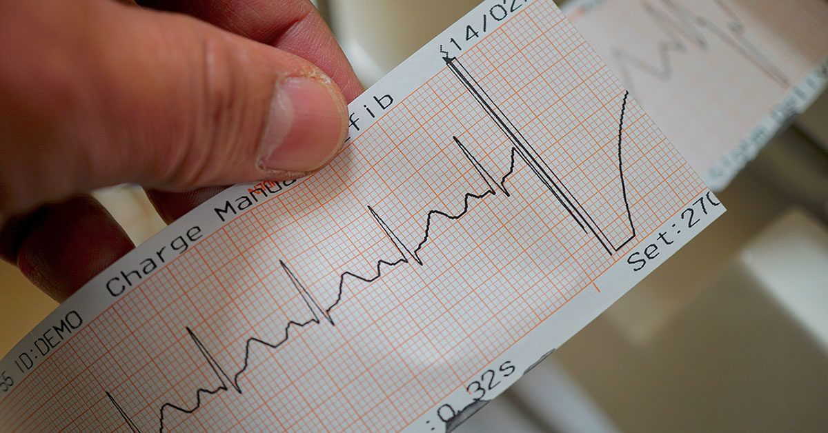 Septic Emboli: Causes, Diagnosis, and Treatment