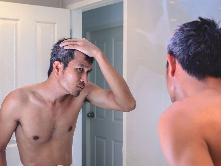 Hair Loss on Temples: Causes and Treatment