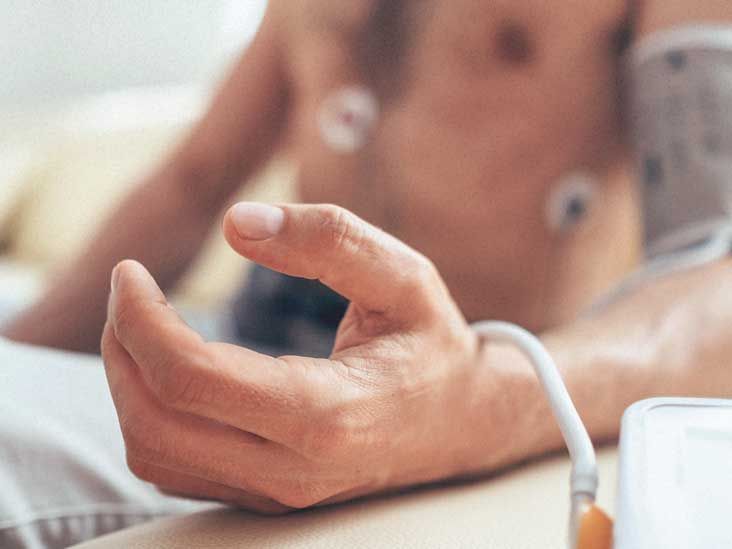 Left Bundle Branch Block: Symptoms, Causes, More