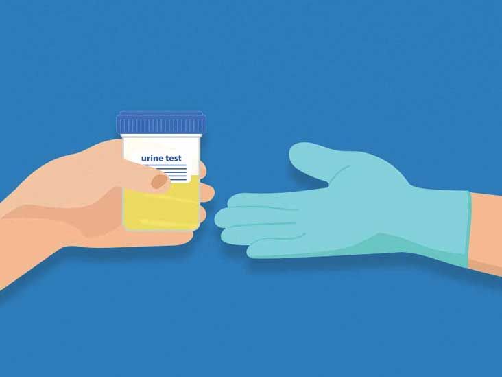 Potassium Urine Test: Causes, Procedure, and Results