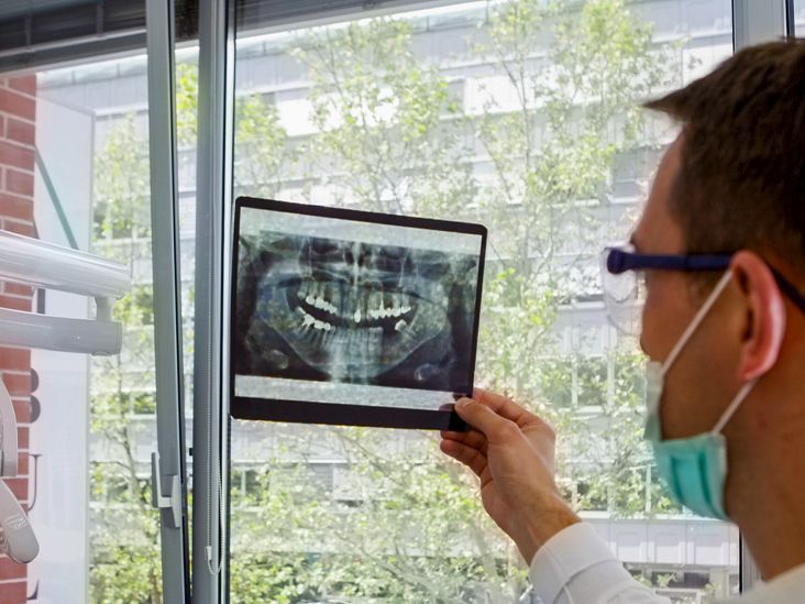 Recessed Maxilla (Upper Jawbone) Symptoms and How to Treat It