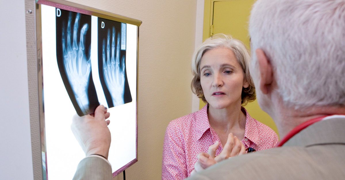 Rheumatoid Arthritis Diagnosis: Tests, Criteria, and More