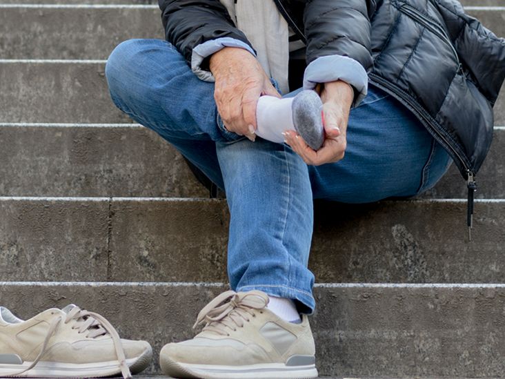 Intermittent Claudication: Definition, Symptoms, Treatment, and More