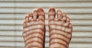 Red Toes Symptoms Causes And Treatments Red Toes Symptoms Causes And Treatments