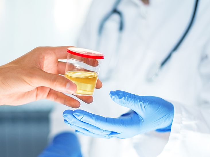 Urine Concentration Test: Purpose, Procedure, and Results