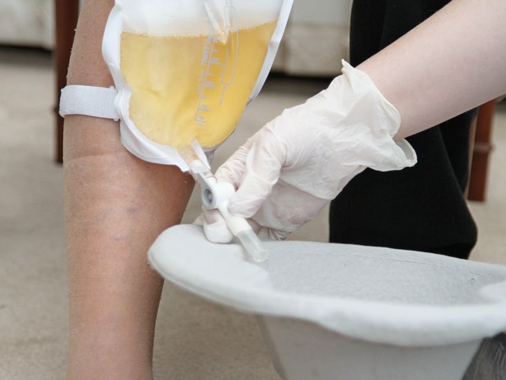 Urologic Diseases: Overviews & Tips