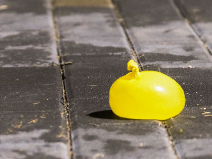 Atonic Bladder: Definition, Symptoms, Causes, and Treatment