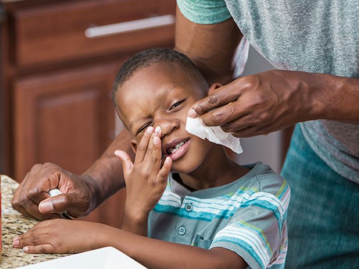 Allergic Salute: Nasal Creases, Prevention, and More