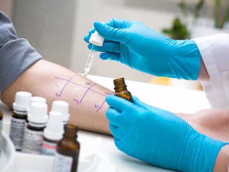 Insect Sting Allergy Tests