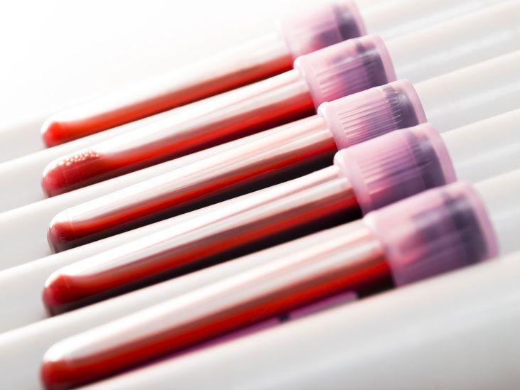 Alpha Fetoprotein Test Prenatal
