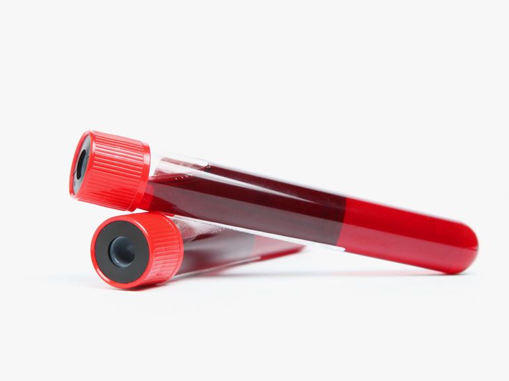 Anti-Smooth Muscle Antibody: Purpose, Risks, and Results