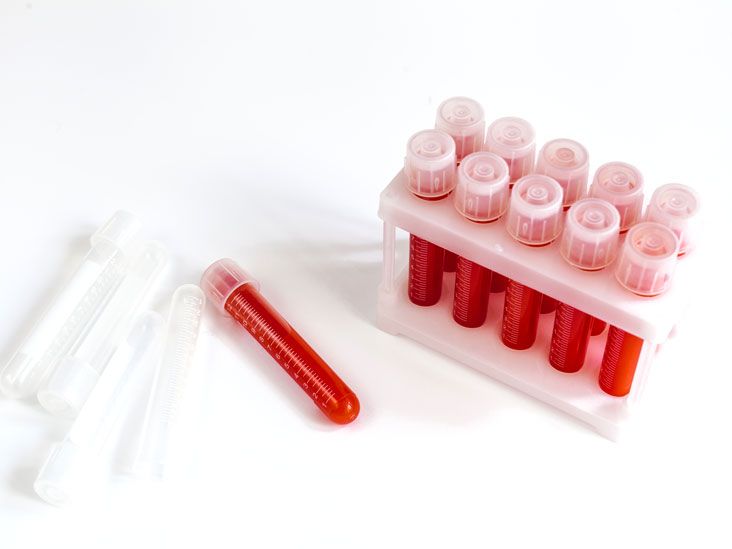 Antimitochondrial Antibody Test: Purpose, Procedure, and Results