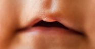 Red Bump On Child S Lip Infoupdate Red Bump On Child S Lip Infoupdate