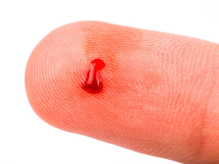 Bleeding Time Test: Purpose, Procedure, and Risks