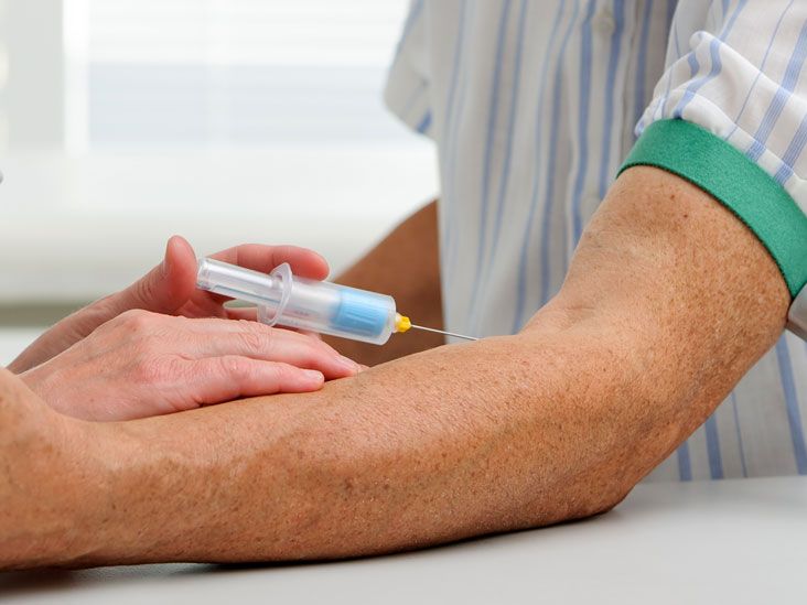 Blood Smear: Purpose, Procedure, and Results