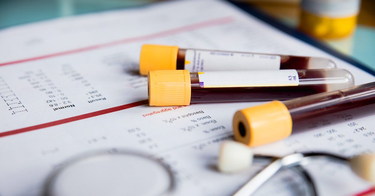 Hepatitis C Tests: Antibody, Qualitative, Quantitative, and More