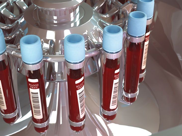 Blood Typing: Purpose, Procedure, and Risks