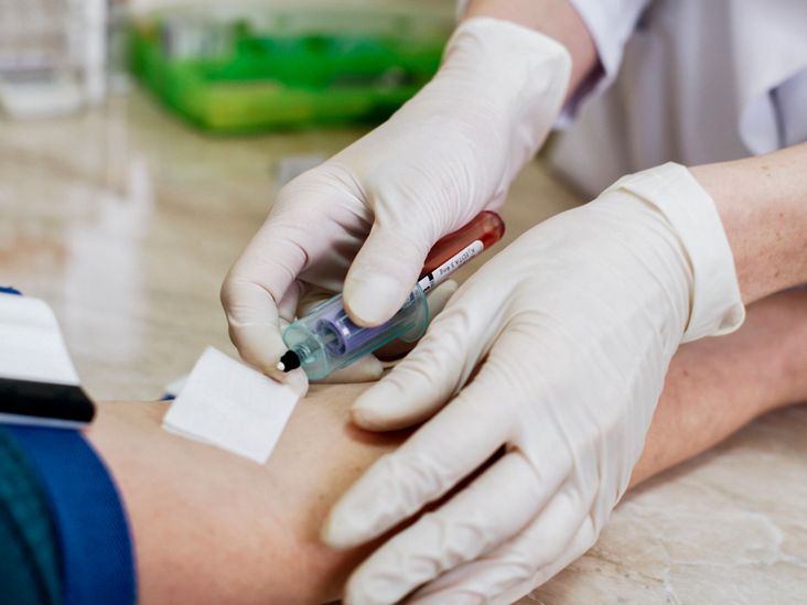 What Is Leukocytosis? Definition, Symptoms, Causes, and More