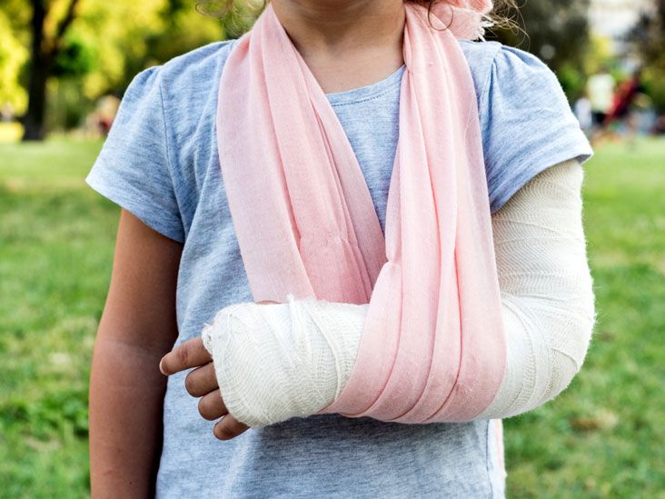 Bone Fracture Repair: Procedure, Preparation, and Risks