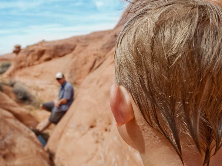 Ears That Stick Out: Causes and Treatment