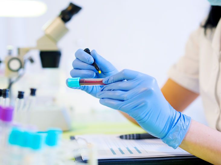 CO2 Blood Test: Purpose, Procedure, and Results