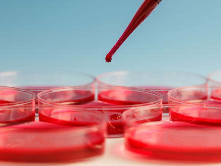 Hereditary Spherocytosis: Causes, Diagnosis, and Treatments