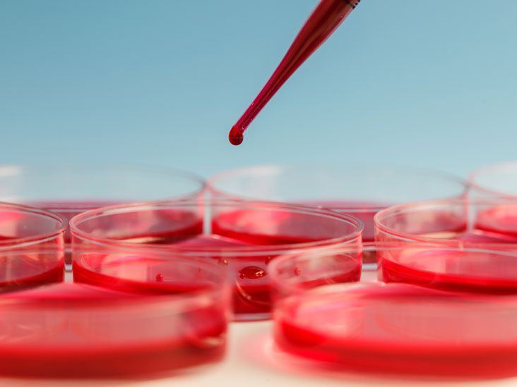 Coombs Test: Purpose, Procedure, and Results