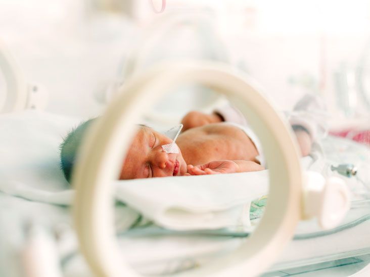 Cri-Du-Chat (Cat’s Cry) Syndrome: Symptoms, Treatment & More