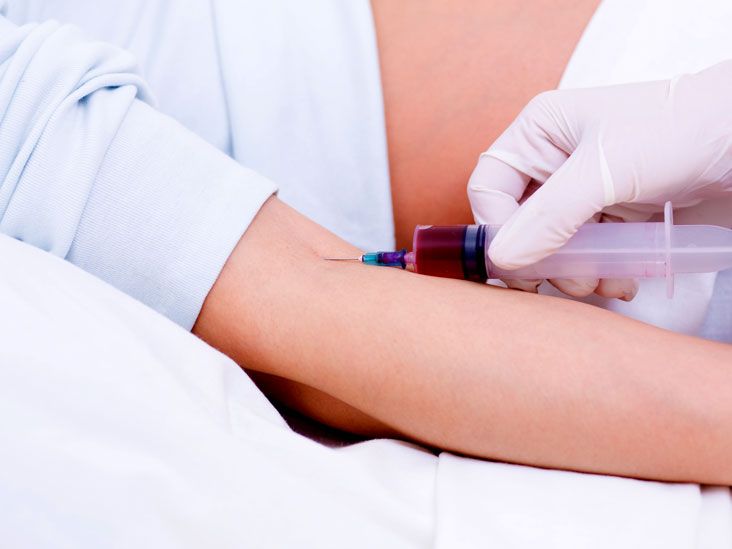 Epstein-Barr Virus (EBV) Test: Purpose, Procedure, and Risks