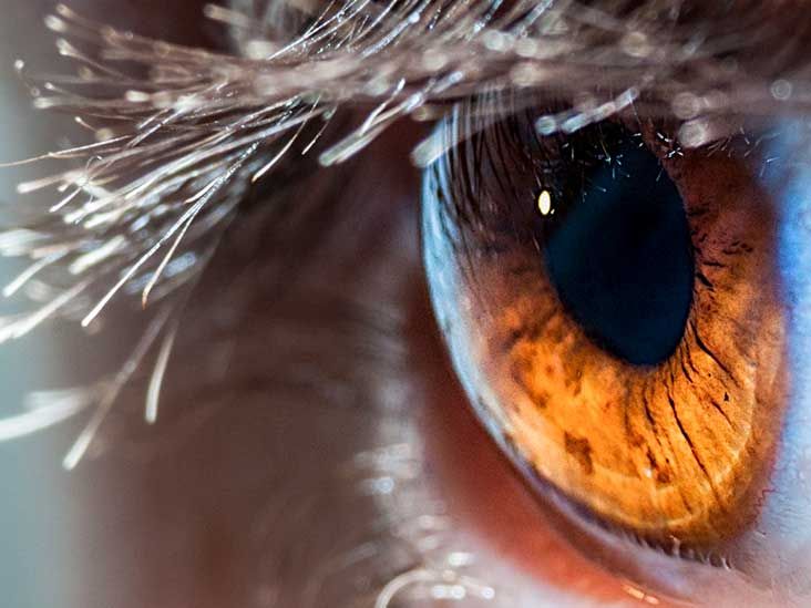 Conjunctival Cyst: Symptoms, Causes, Diagnosis, and Treatment