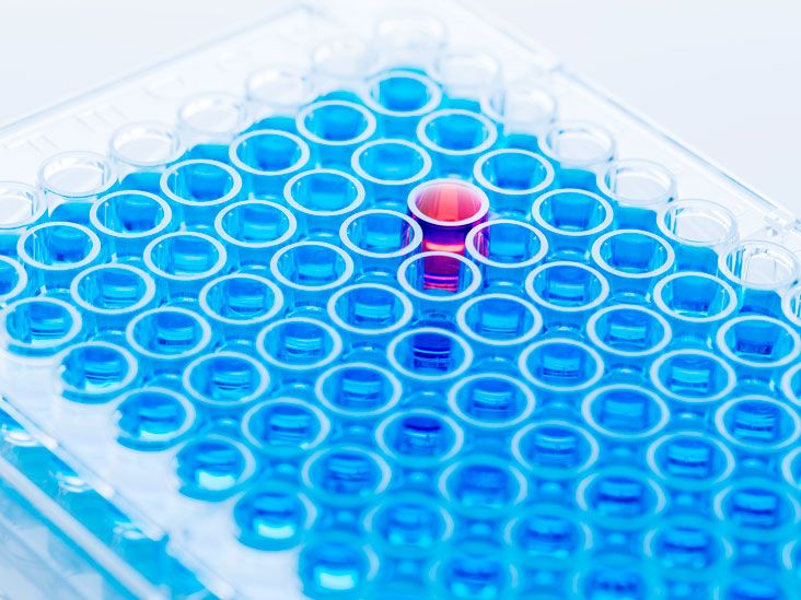 Follicle-Stimulating Hormone (FSH) Test