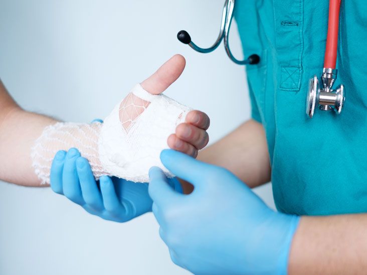 Ganglion Cyst Removal: Procedures, Risks, and Recovery