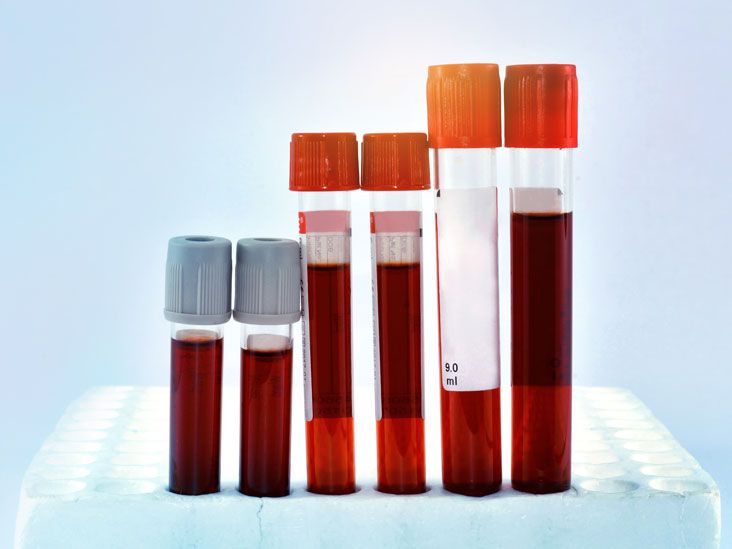 Hematocrit Test: Uses, Procedure, and Results