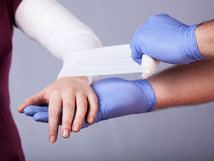 How to Make A Splint: Materials You’ll Need, Hand Splints, and More