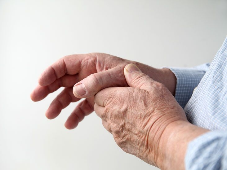 Musculoskeletal Disorders: Definition and Patient Education