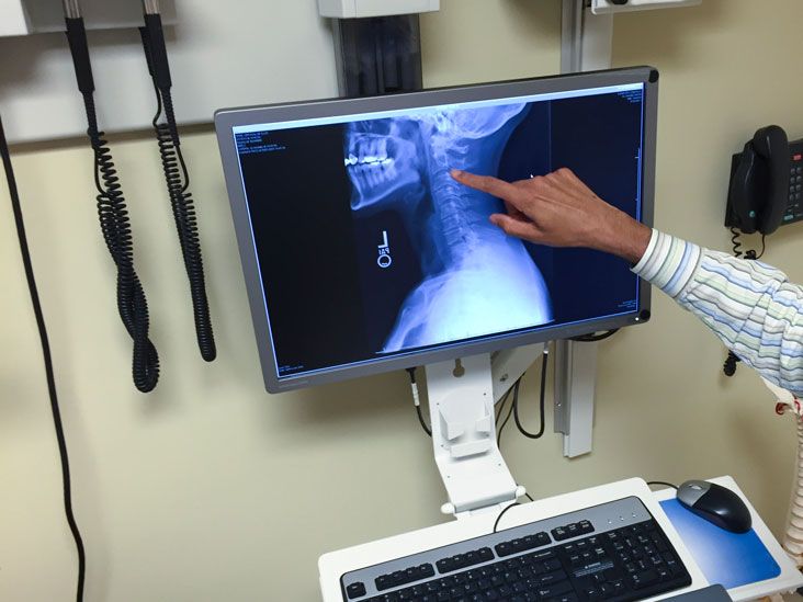 Neck X-Ray: Purpose, Procedure, and Results