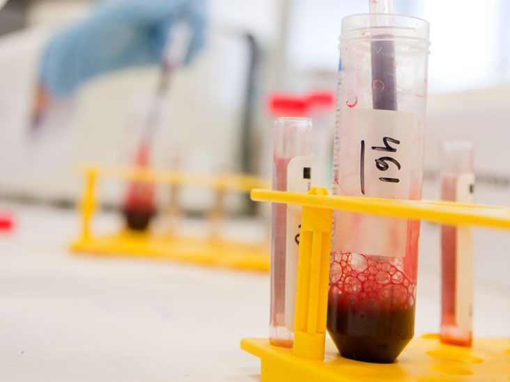 Reticulocyte Count: Purpose, Procedure, and Results