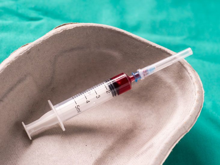 Serology Blood Test Status™ Mono, Rapid Test For Mononucleosis