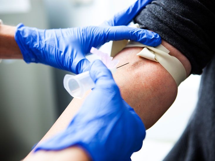 Serum Iron Test: Purpose, Procedure, and Results
