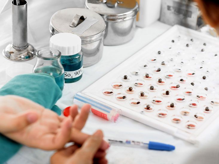 Sickle Cell Test: Preparation, Procedure, Risks, and More