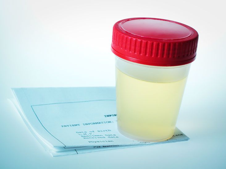 Uroflowmetry: Purpose, Procedure, and Results