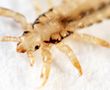 How to Kill and Get Rid of Head Lice: Treatment and Remedies