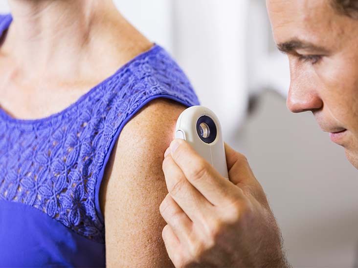 Cutaneous Horn: Pictures, Removal, Causes, and More