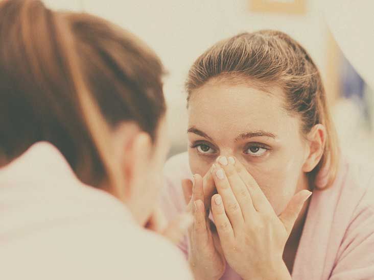 Nose Acne: Causes, Treatment, and More