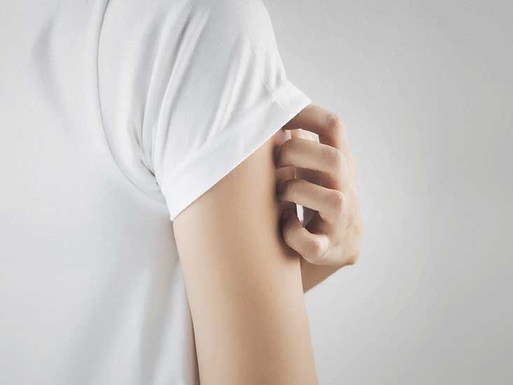 Excoriation (Skin Picking) Disorder: What Is It?