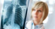COPD Doctors: Primary Care, Specialists, and More